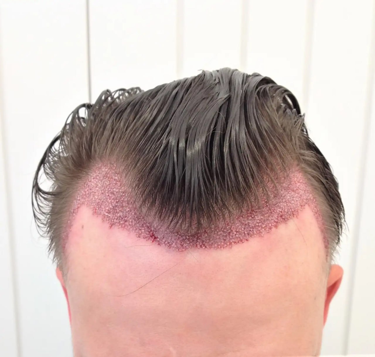 DHI Technic - Chic Clinic Istanbul